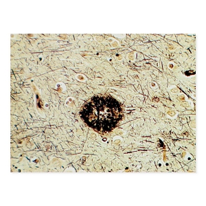 Modified Bielschowsky Stain Kit | Medline Industries, Inc.