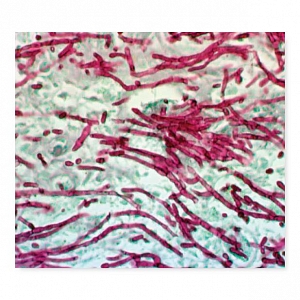 MarketLab PAS Stain Kit | Medline Industries, Inc.