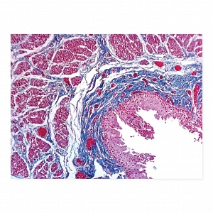 Masson Trichrome Stain Kit by MarketLab | Medline Industries, Inc.