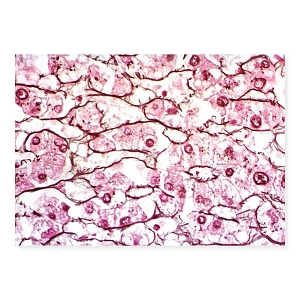 Chandler Reticulum Stain Kit | Medline Industries, Inc.