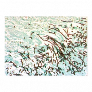 G. M.S. Stain Set | Medline Industries, Inc.