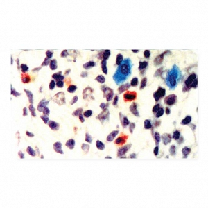 CEM Stain Kit | Medline Industries, Inc.