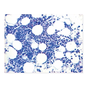 Giemsa-May-Grunwald Stain Kit | Medline Industries, Inc.