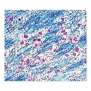 Luxol Fast Blue-CE Violet Kit | Medline Industries, Inc.