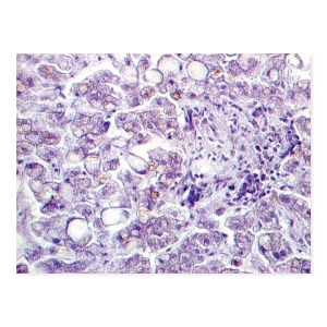 Microwave Copper Stain Kit | Medline Industries, Inc.