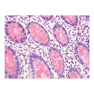 MarketLab Muci Plus Stain Kit | Medline Industries, Inc.