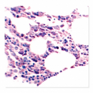 Optimized Giemsa Stain Kit Kit | Medline Industries, Inc.