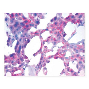 Oil Red O Stain Kit | Medline Industries, Inc.