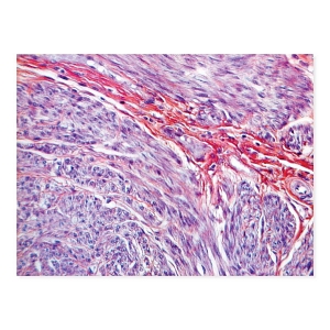 PTAH Stain Kit | Medline Industries, Inc.