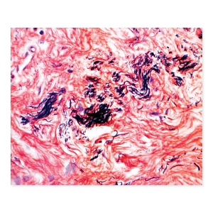 Russell-Movat Pentachrome Kit | Medline Industries, Inc.