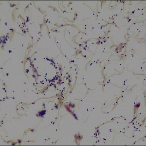 Millipore Tissue Gram Stain | Medline Industries, Inc.