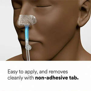 3M Nasogastric Securement Device | Medline