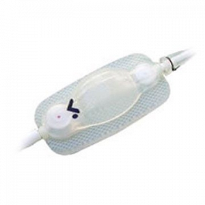 Strata Shunt Kit with Closed-Tip Lumbar Catheter | Medline Industries, Inc.