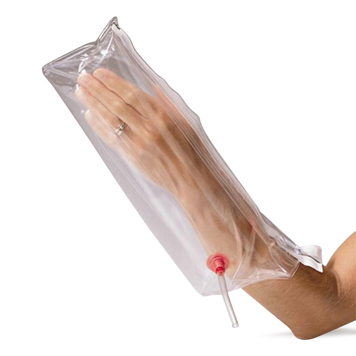 Mayflower Splint Inflatable Air Hand and Wrist Splint | Medline