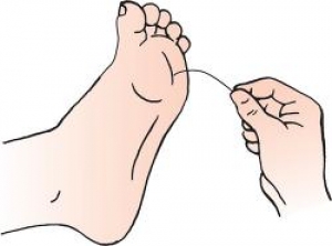 Diabetic Monofilament Tests | Medline Industries, Inc.