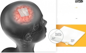 DuraGen Suturable Collagen Matrix Patch by Integra LifeSciences ...