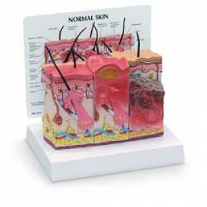 Skin Burn / Normal Educational Training Model | Medline Industries, Inc.