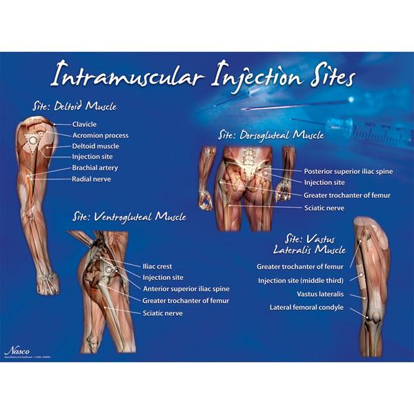 Intramuscular Injection Sites Sets | Medline