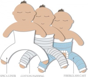 SPICA SKINZ Hip Spica Liners | Medline Industries, Inc.