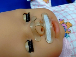 Septal-H Gentle Cannula Stabilization Devices | Medline Industries, Inc.