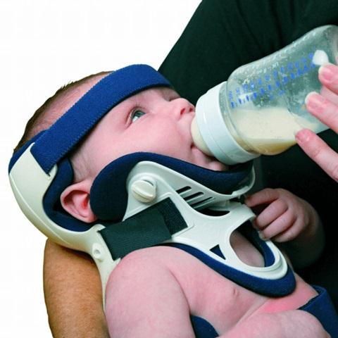 Papoose Infant Immobilizer | Medline
