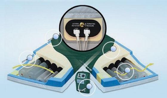 PressureGuard APM 2.0 Mattresses | Medline