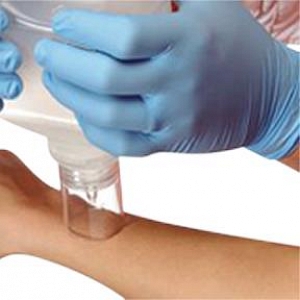 SplashCap Wound Irrigation Shields | Medline Industries, Inc.