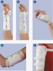 Specialist Fracture Bracing | Medline Industries, Inc.