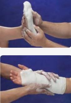 Fast-Set OCL Plaster Bandages | Medline