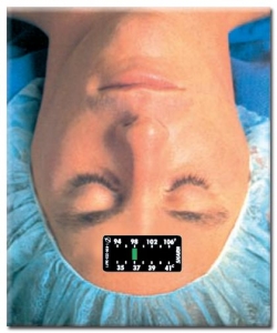 TempAlert II Temperature Indicator Strips | Medline