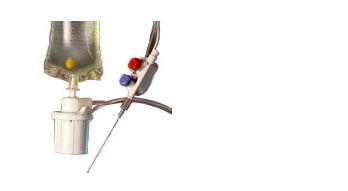 StrykeFlow 2 System | Medline