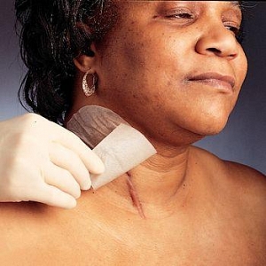 Mepiform Self-Adherent Silicone Dressing | Medline Industries, Inc.