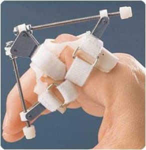 Static Progressive Finger Flexion Splints | Medline Industries, Inc.