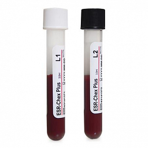 ESR-Chex Plus Sedimentation Rate Controls | Medline