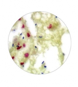 Modified Brown and Brenn Gram Stain Kit | Medline Industries, Inc.