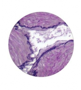 Elastic (Mod. Verhoff's) Stain Kit | Medline Industries, Inc.