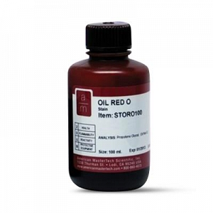 Oil Red O Stain Kit (For Fat)by Statlab Medical Products | Medline ...
