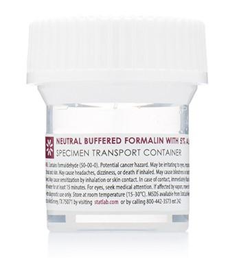 StatLab Neutral-Buffered Formalin with 5% Alcohol | Medline