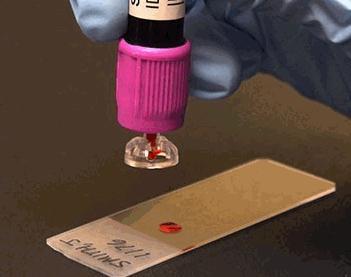 Smearsafe Blood Dispenser | Medline