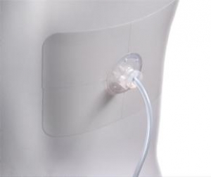 Tru-Fix Catheter Patch Replacement | Medline