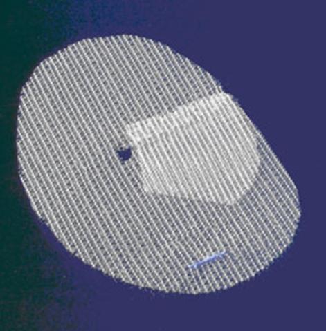 Parietex ProGrip Self-Fixating Mesh | Medline