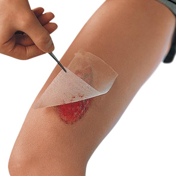 Cuticerin Gauze Dressings | Medline