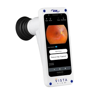 VistaView Retina Camera | Medline Industries, Inc.