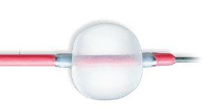 Over-The-Wire Fogarty Thru-Lumen Embolectomy Catheters | Medline