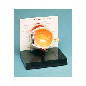 Hilco Cutaway Human Eye Model | Medline Industries, Inc.