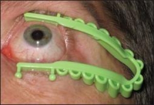 Multi-tension Eye Speculums by Wilson Ophthalmic Corporation | Medline ...