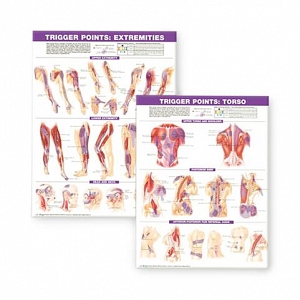 Trigger Points Torso and Extremities Chart Set | Medline Industries, Inc.