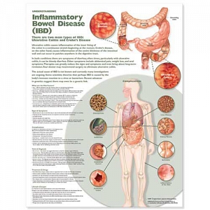 Understanding Inflammatory Bowel Disease Anatomical Chart | Medline ...