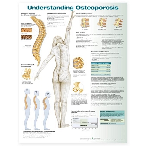Understanding Osteoporosis Anatomical Chart | Medline Industries, Inc.
