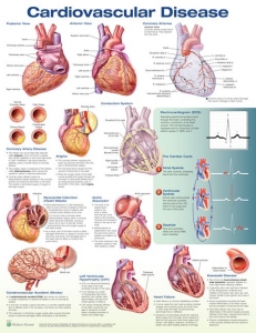 Cardiovascular Disease Chart | Medline Industries, Inc.